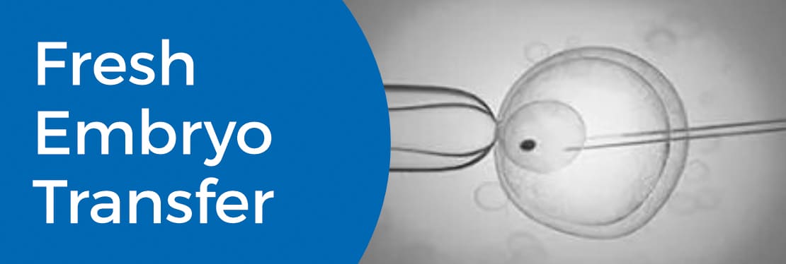 Fresh Embryo Transfer Procedure - IVF | Milann The Fertility Specialists