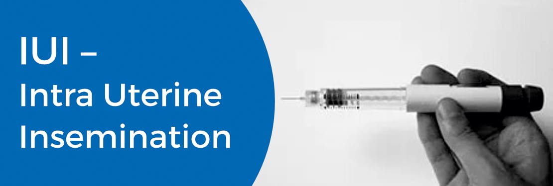 Intrauterine Insemination (IUI): Procedure, Treatment and Risks ...
