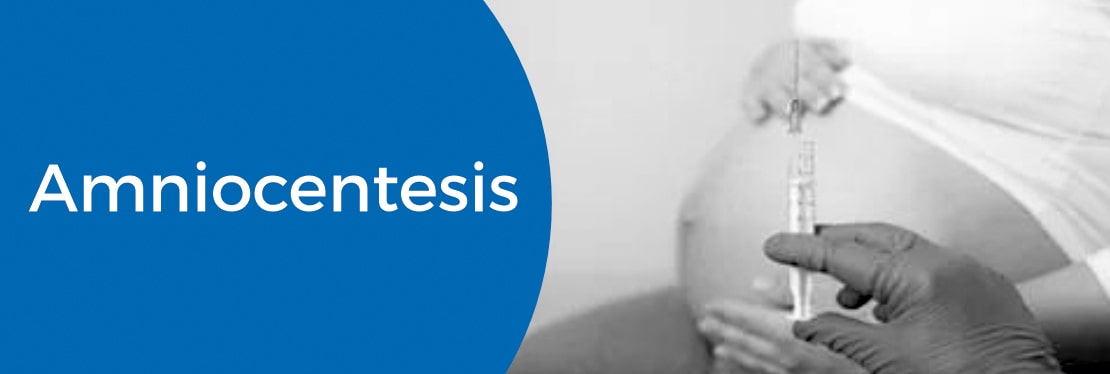 Amniocentesis: Prenatal Testing for Healthy Pregnancy | Milann The ...