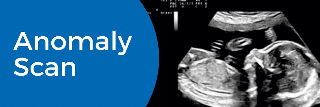 Why Is Anomaly Scan Done? | Milann The Fertility Specialists
