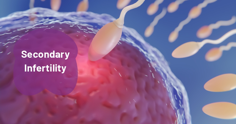 Milann | The Fertility Specialist